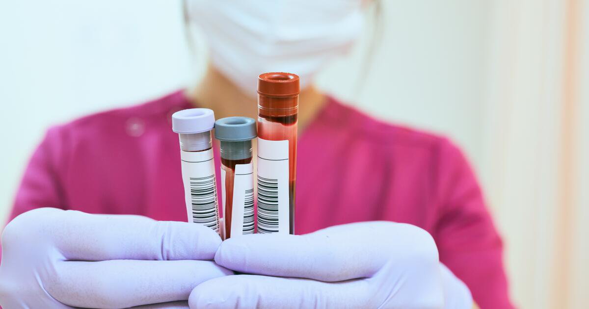 How Can I Decrease Platelet Count Find Your Answers 6443